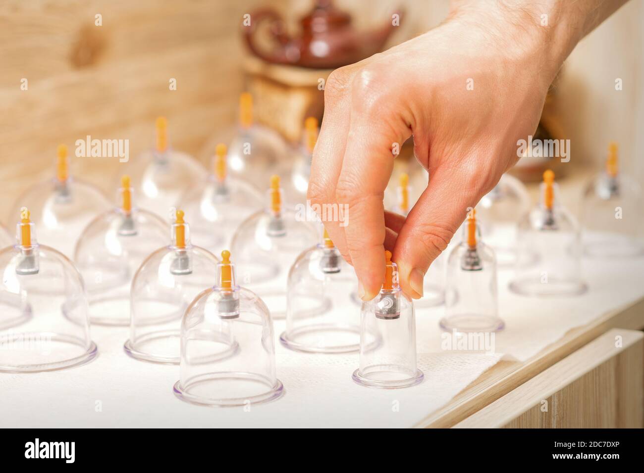 Masseur takes vacuum massage glass jars of traditional Chinese cupping ...