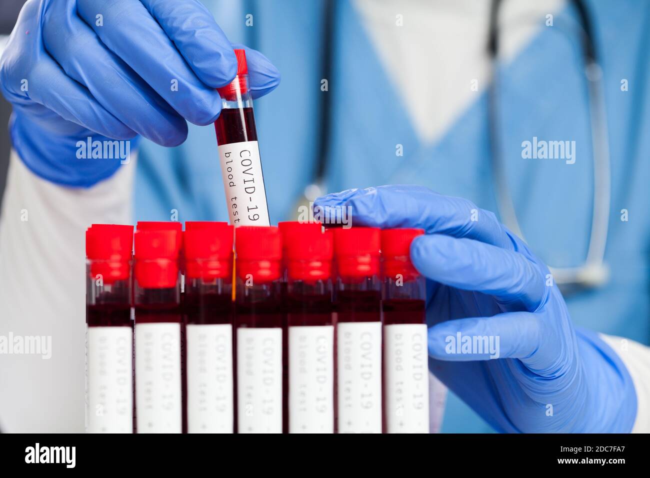Doctor pulling out a red test tube with Coronavirus patient blood ...