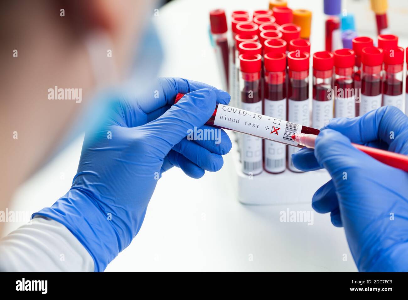 Doctor or lab scientist labelling test tube with Coronavirus patient ...
