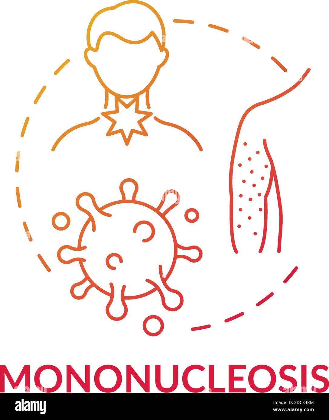 Infectious mononucleosis Stock Vector Images - Alamy