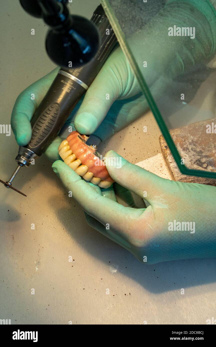 Polishing dental crown by dentist hi-res stock photography and images ...