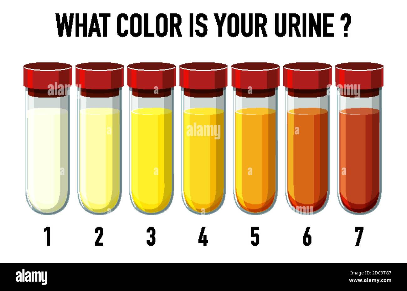 Illustration of urine color chart illustration Stock Vector Image & Art ...