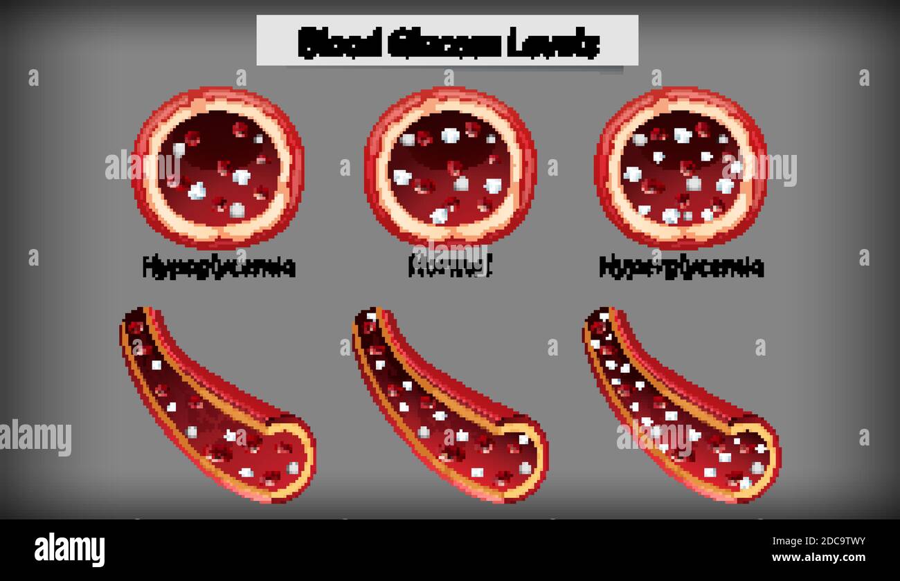 Medical blood glucose level illustration Stock Vector Image & Art - Alamy