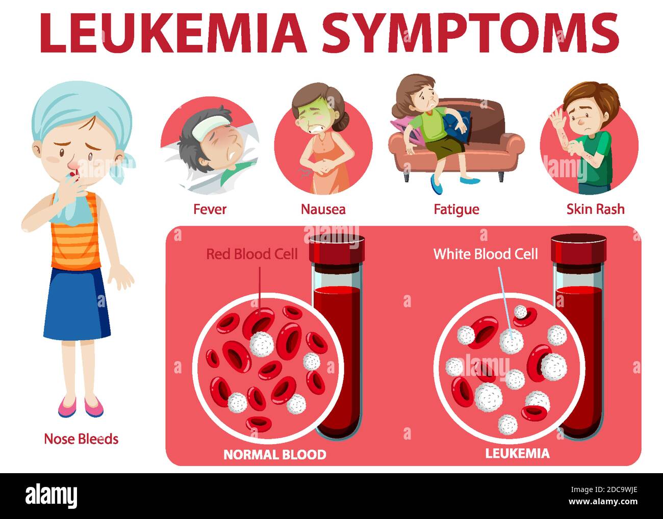 Leukemia symptoms cartoon style infographic illustration Stock Vector ...