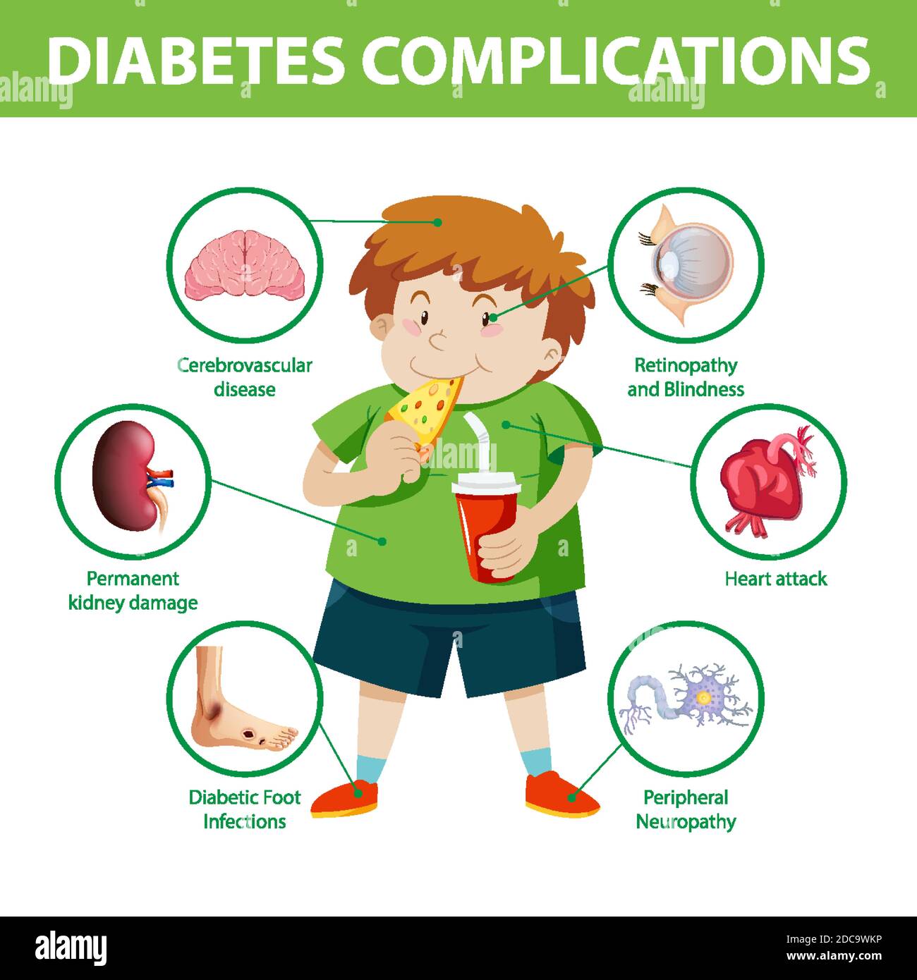 Diabetes complications information infographic illustration Stock ...