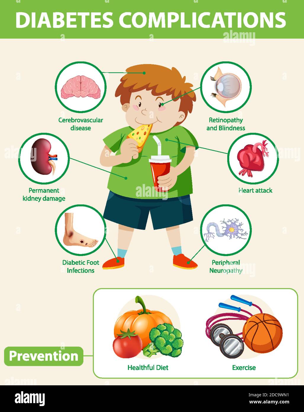 Medical infographic of diabetes complications and preventions ...