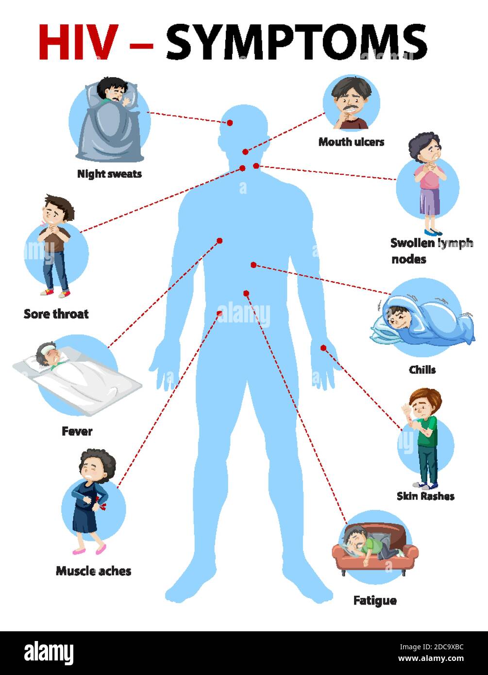 Symptoms Of Hiv Infection Infographic Stock Vector Il