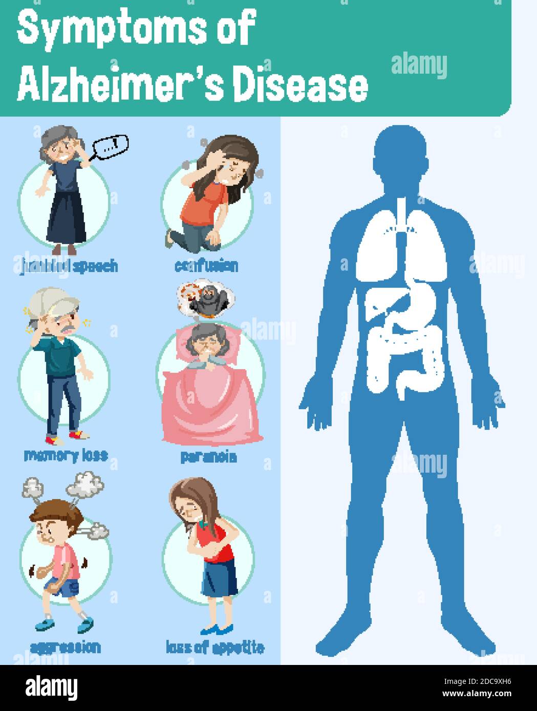Symptoms of Alzheimer's Disease Infographic illustration Stock Vector Image & Art - Alamy