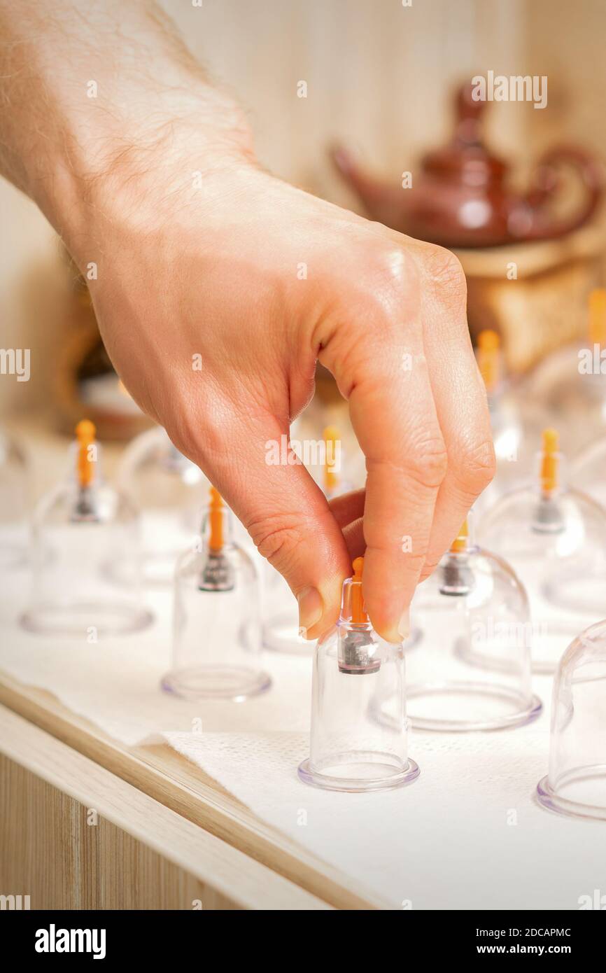 Masseur takes vacuum massage glass jars of traditional Chinese cupping ...