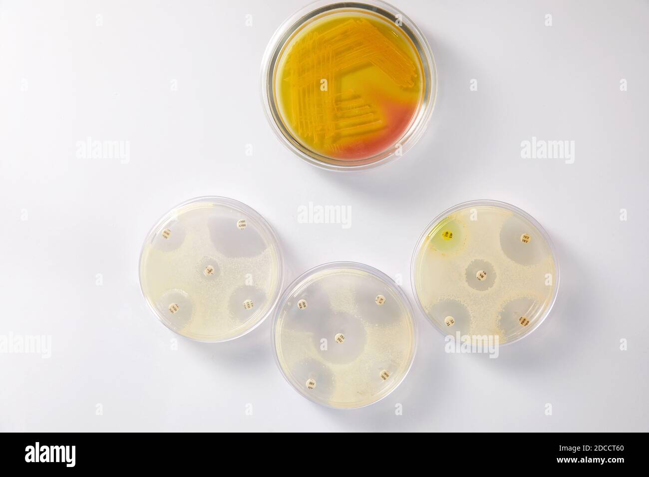 Microbiology Laboratory. Petri Dishes with Various Bacteria Samples ...