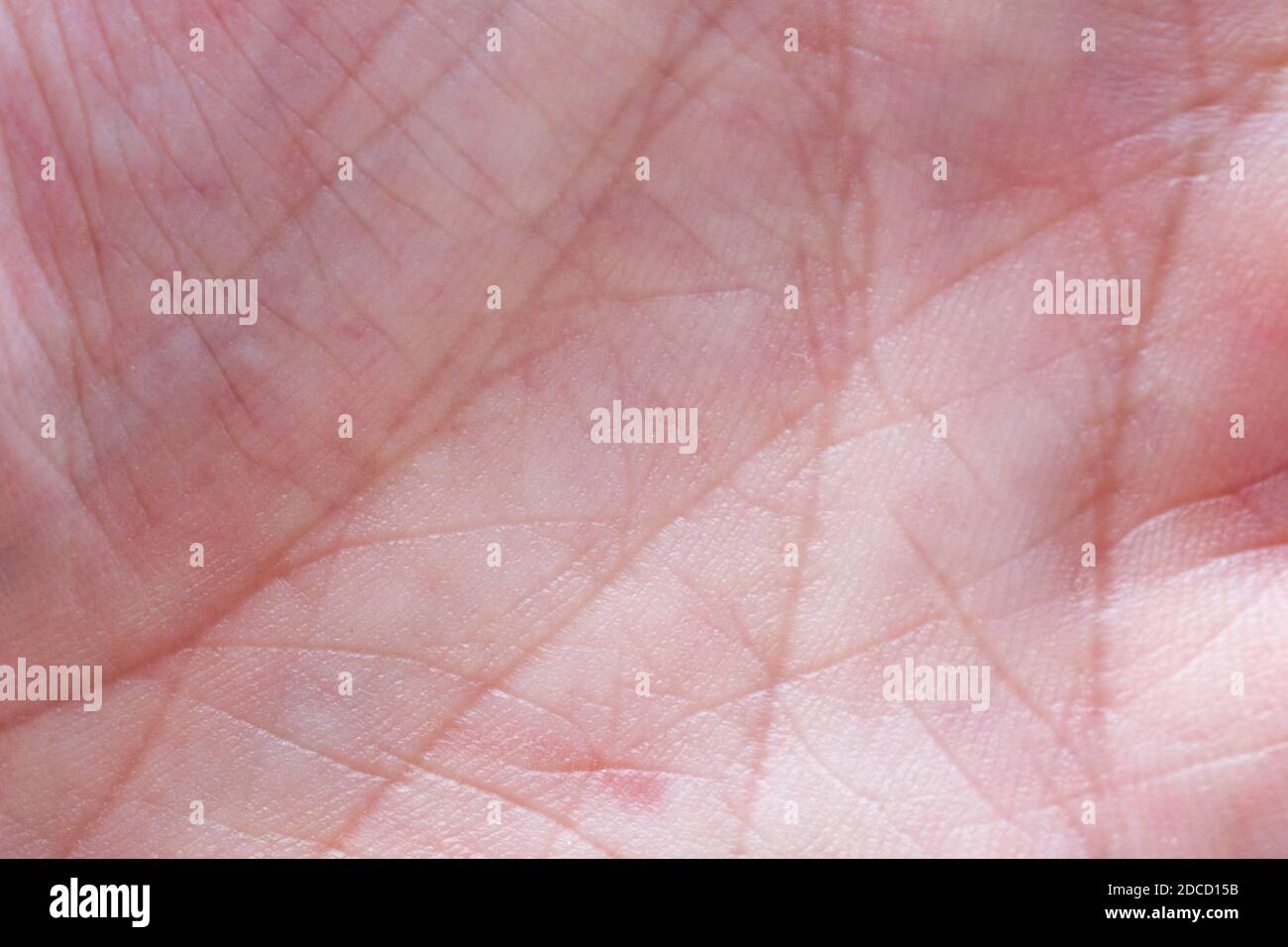 Close up of human hand palm with visible lines. Skin texture background ...