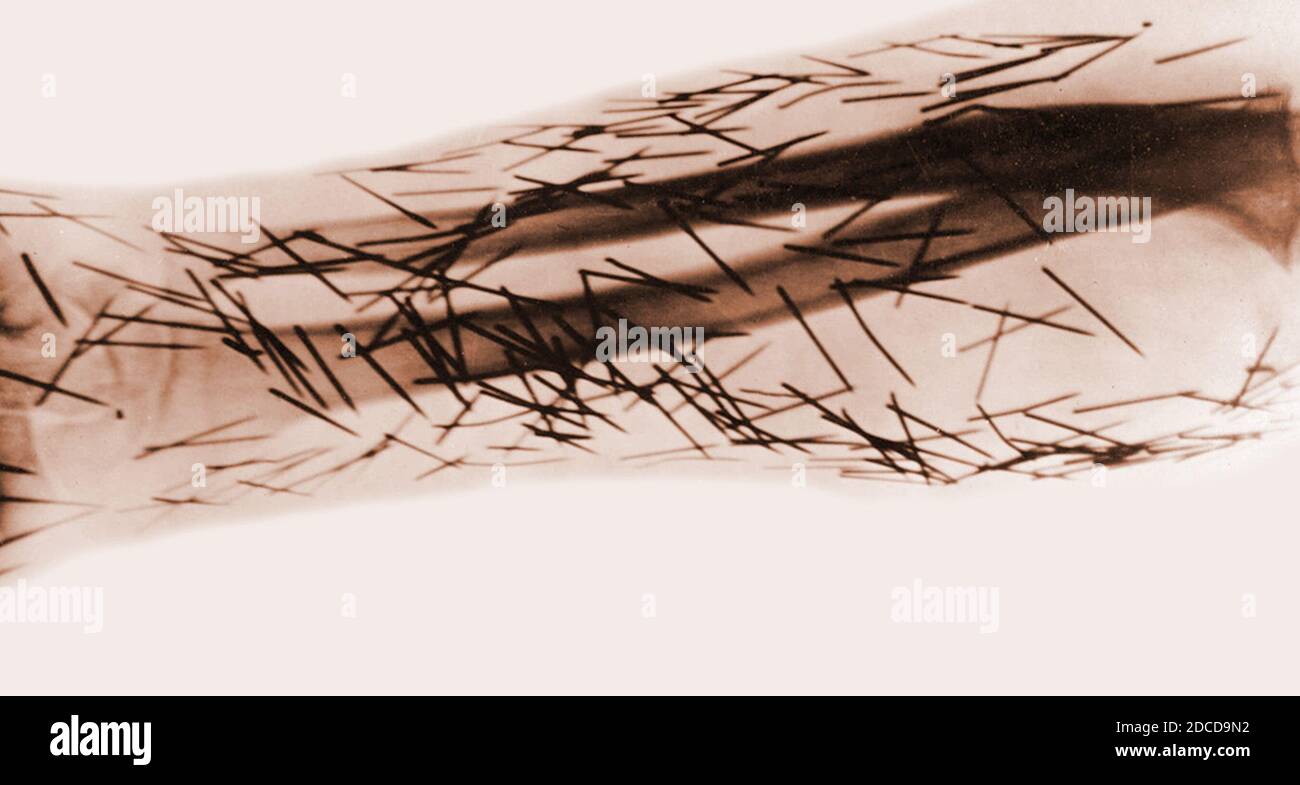 Self mutilation arm hi-res stock photography and images - Alamy