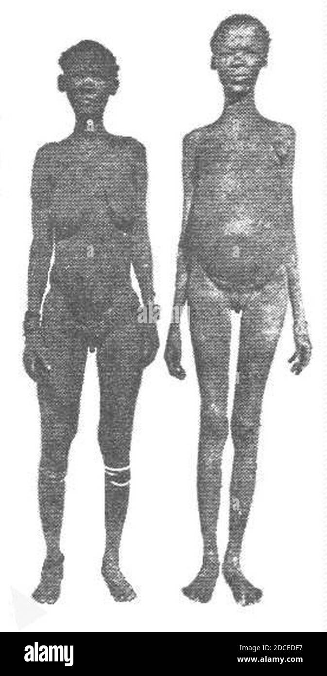 Khoisan hi-res stock photography and images - Alamy