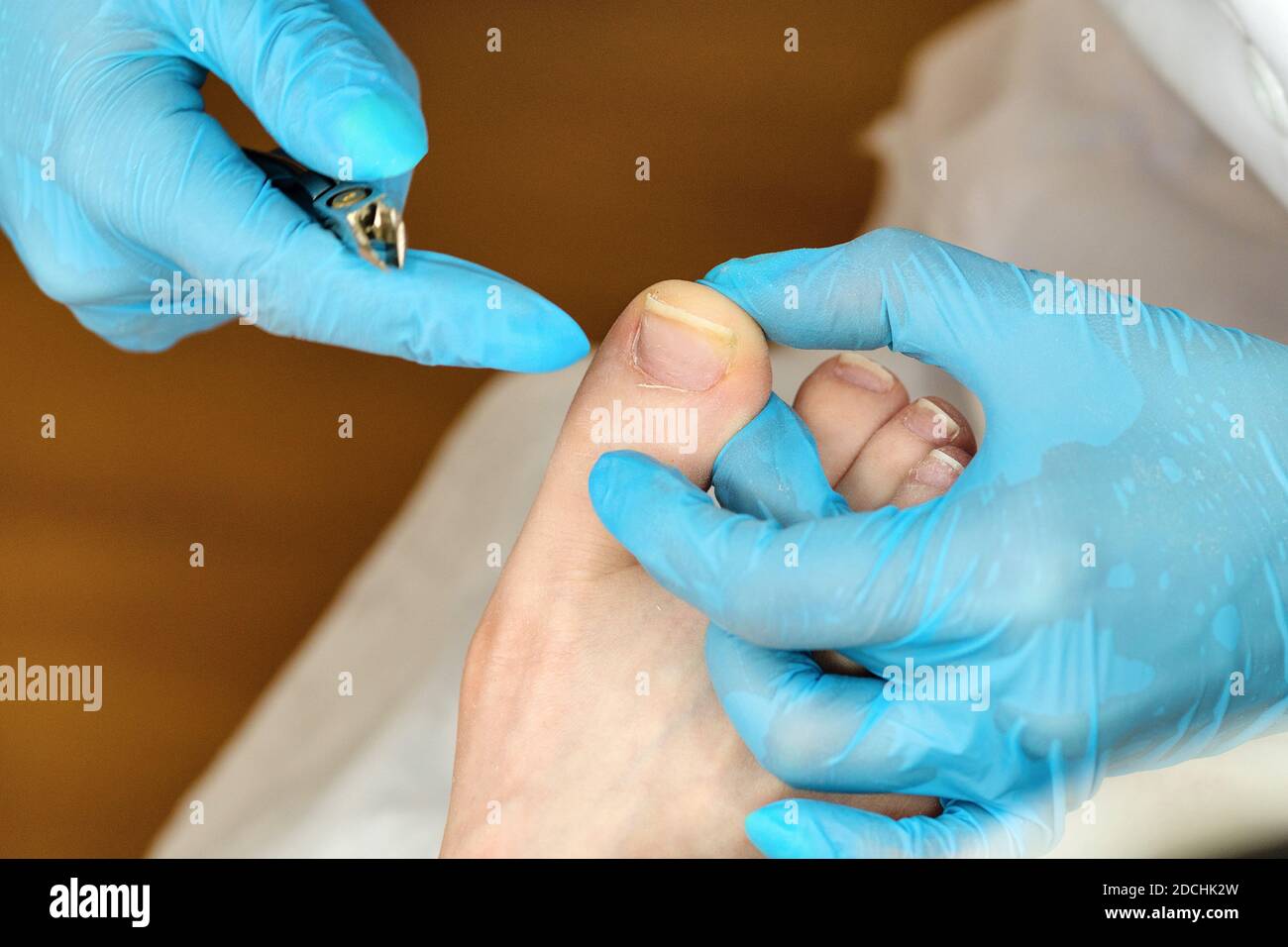 Master chiropody removes the cuticle. Cuticle treatment is one of the ...