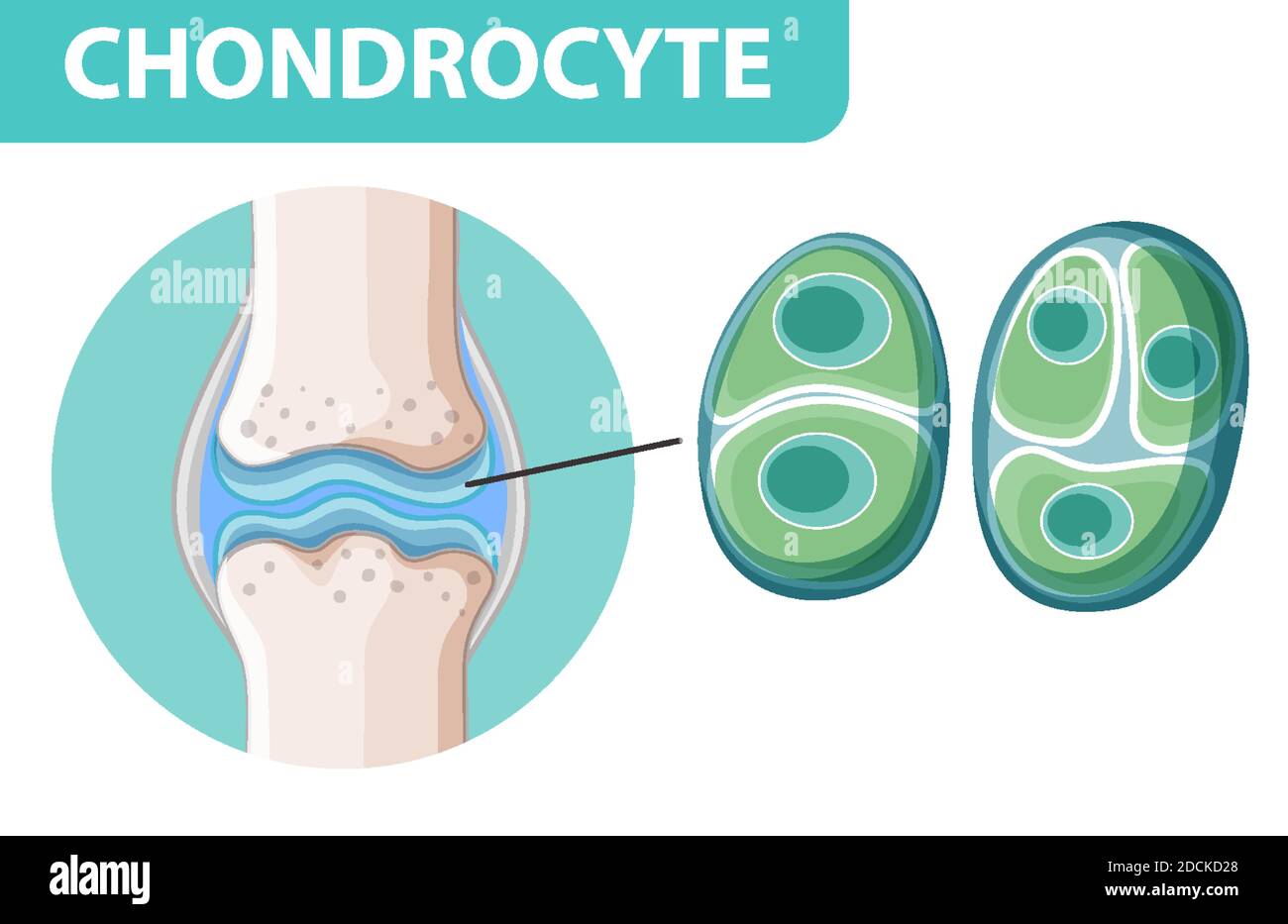 Informative poster of chondrocyte illustration Stock Vector Image & Art ...