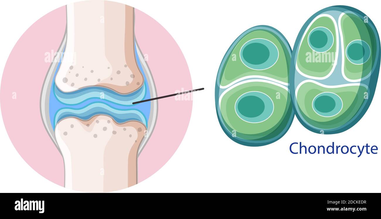 Informative poster of chondrocyte illustration Stock Vector Image & Art ...