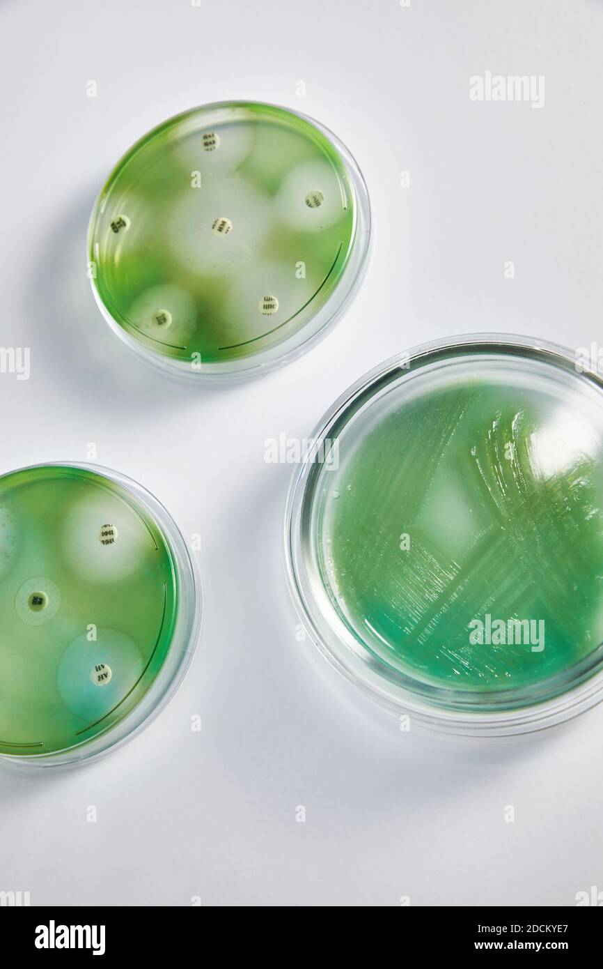 Microbiology Laboratory. Petri Dishes with Various Bacteria Samples ...