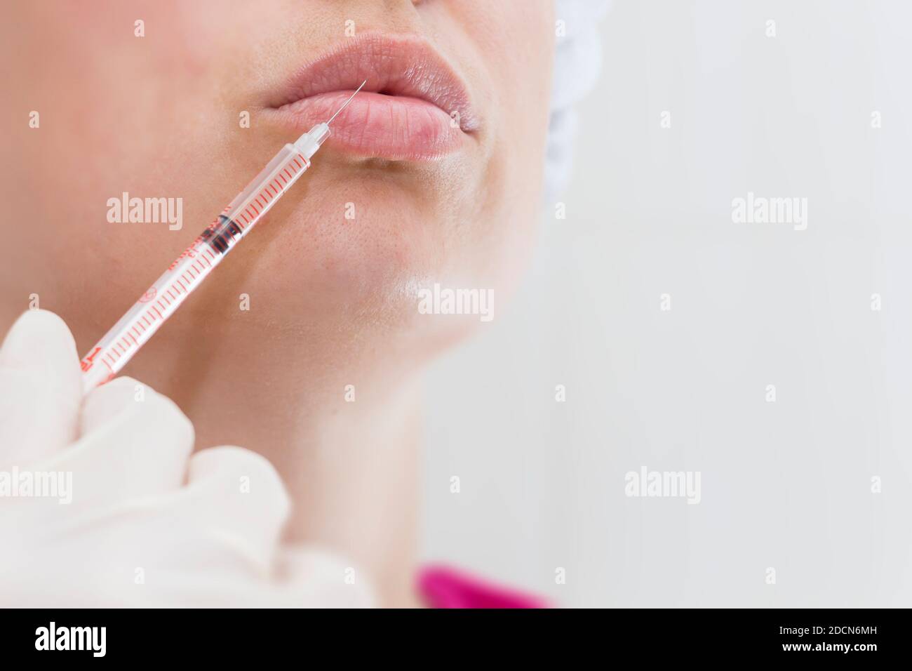 young woman gets injection in her lips. Woman in beauty salon. plastic ...
