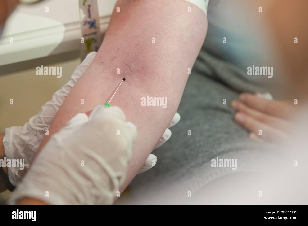Medical needle hi-res stock photography and images - Alamy
