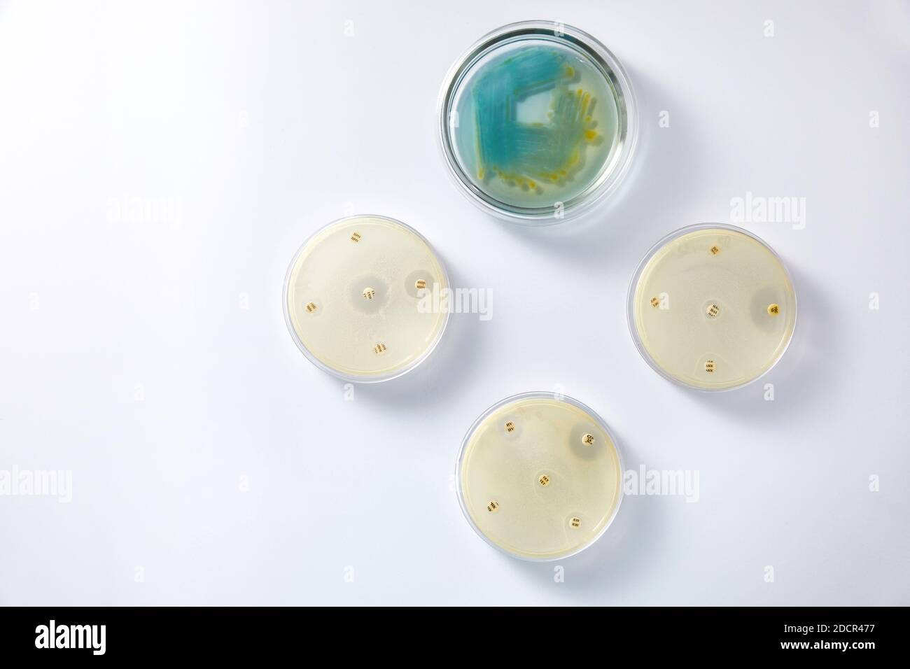 Microbiology Laboratory. Petri Dishes with Various Bacteria Samples ...