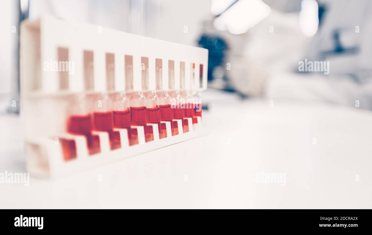 background image of a test tube with test results on a table in the ...