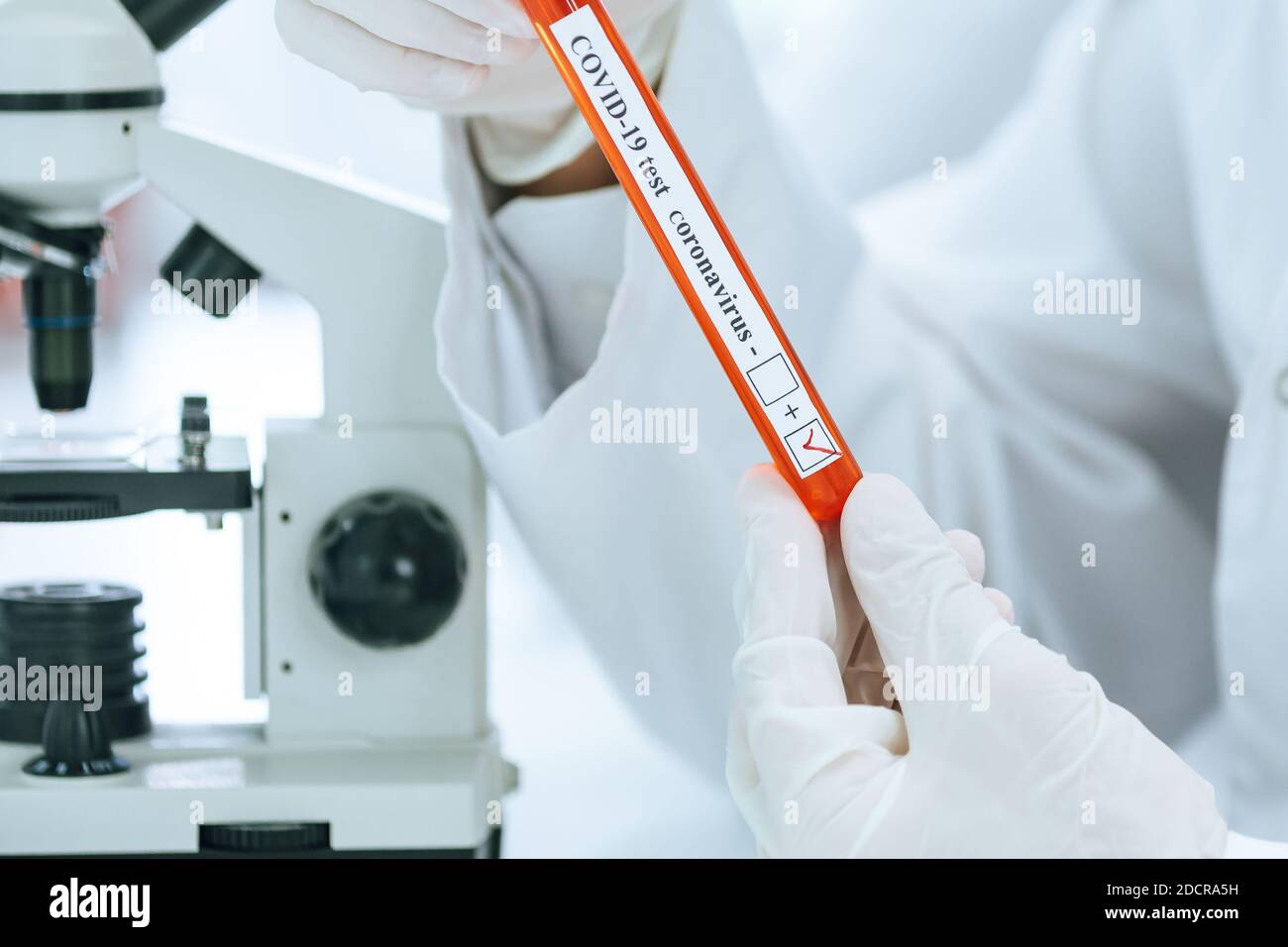 tube with the test in the hands of a laboratory employee Stock Photo ...