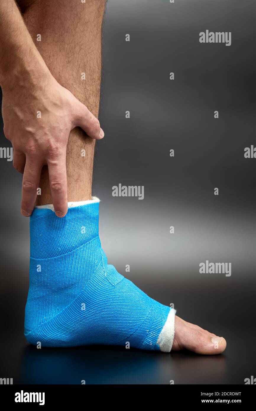 Plaster splint gypsum hi-res stock photography and images - Alamy