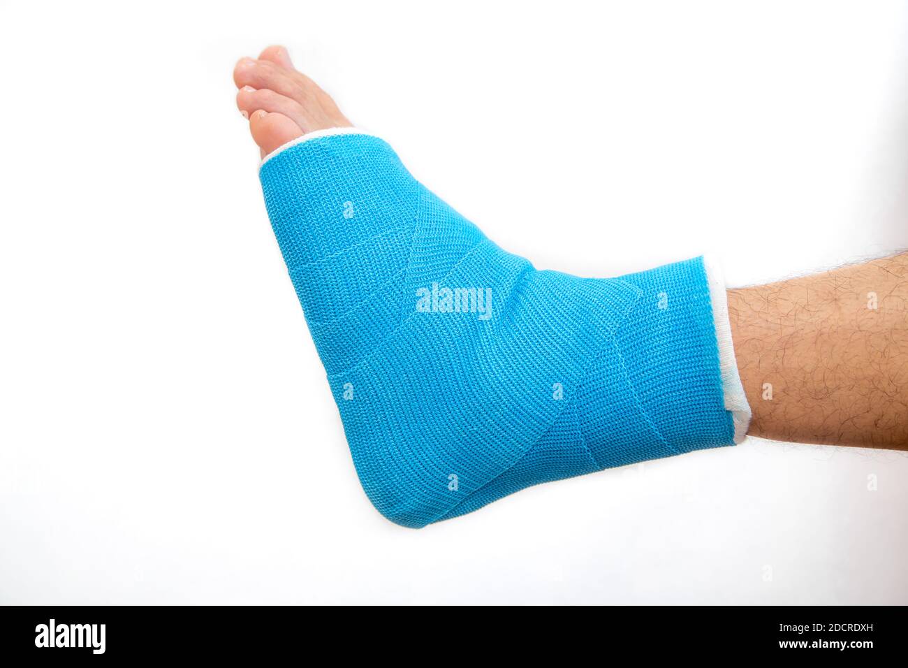 Blue splint ankle. Bandaged leg cast on male patient on white ...
