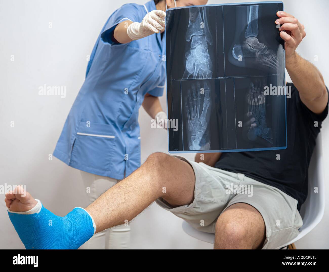 Lower leg fracture x ray hi-res stock photography and images - Alamy