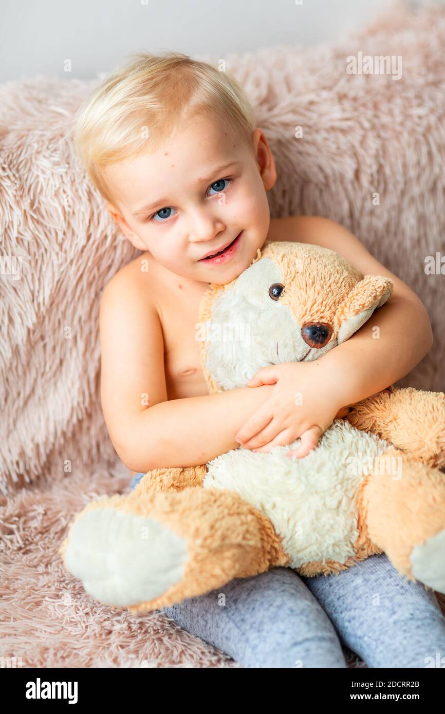 Little baby boy with Varicella virus or Chickenpox bubble rash at home ...