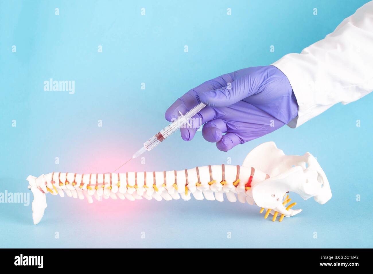 A model of the human spine on a blue background in which the doctor ...