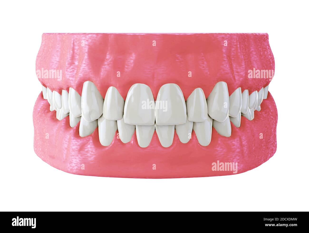 human jaw with straight white teeth, correct bite, 3d render Stock ...
