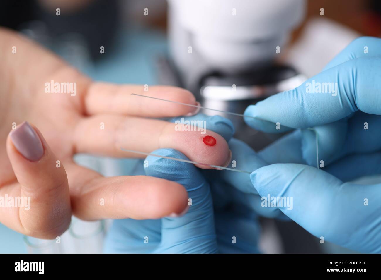 Doctor in protective gloves touching drop of blood on patients hand ...