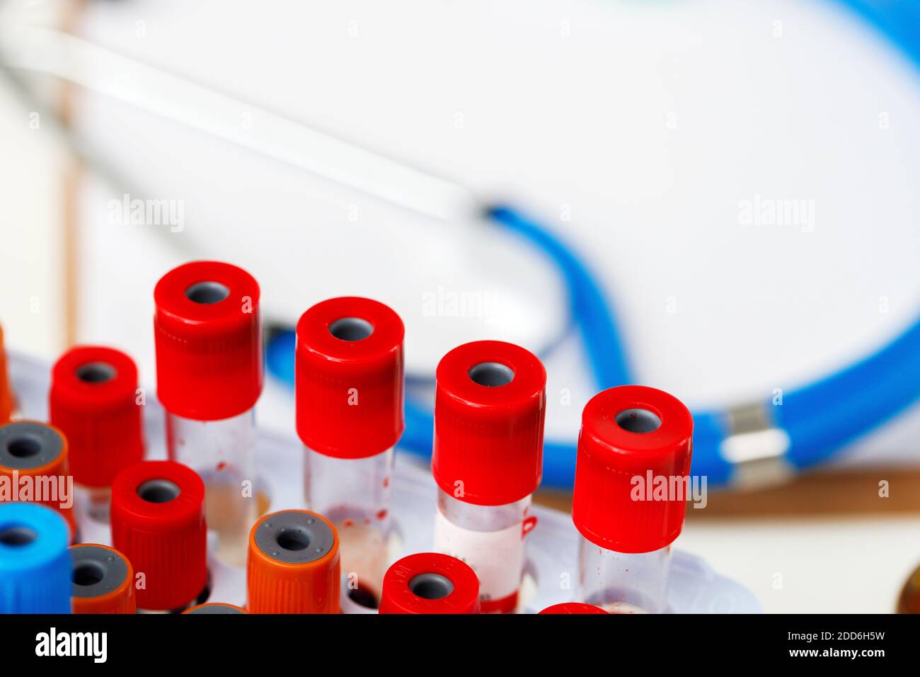 Test tubes tops in a tray close up Stock Photo - Alamy