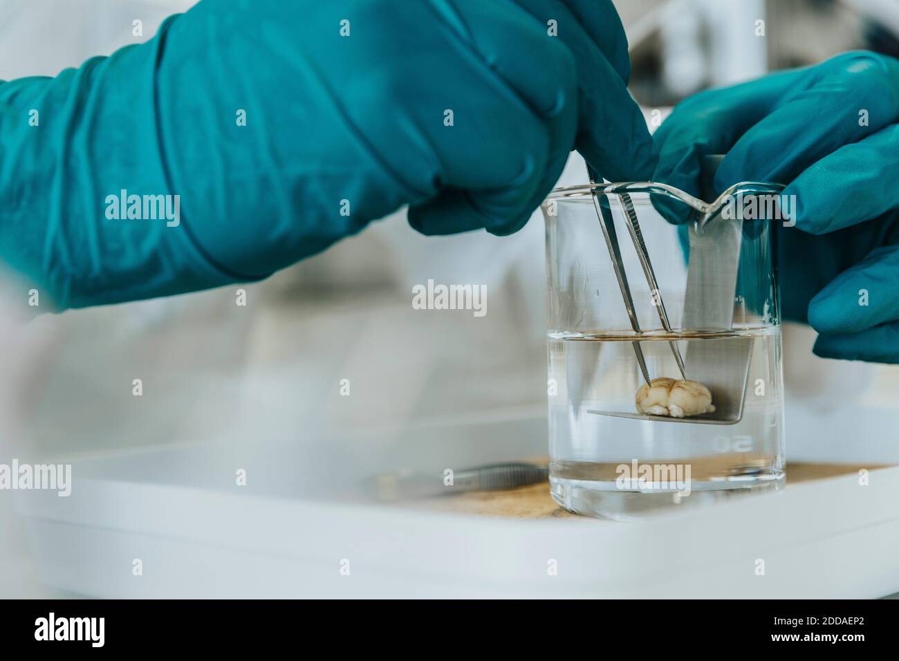 Close-up of scientist hands removing rodent brain from beaker through ...