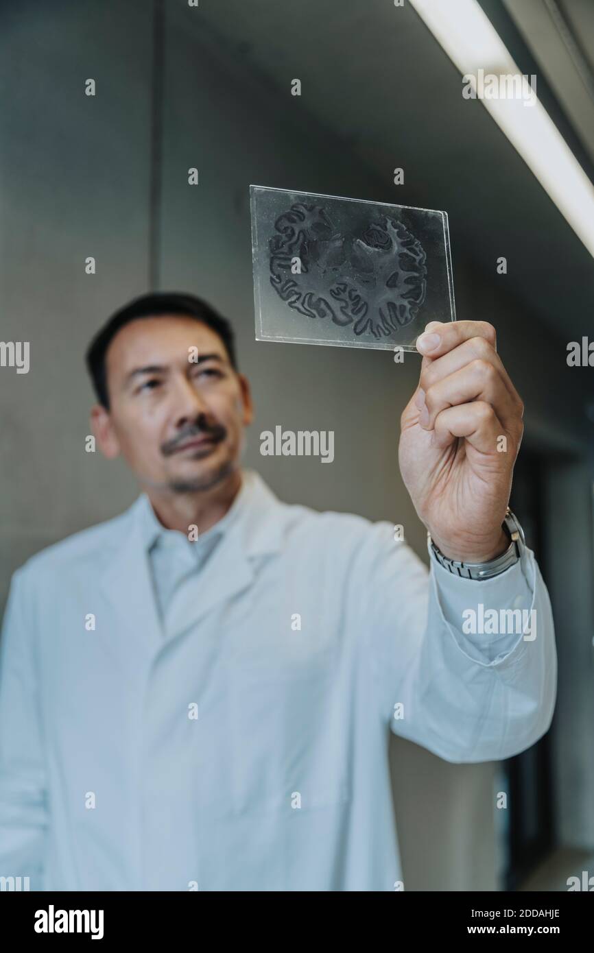 Brain sample hi-res stock photography and images - Alamy