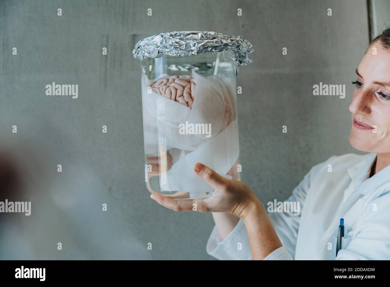 Scientist holding preserved human brain beaker while standing at clinic ...