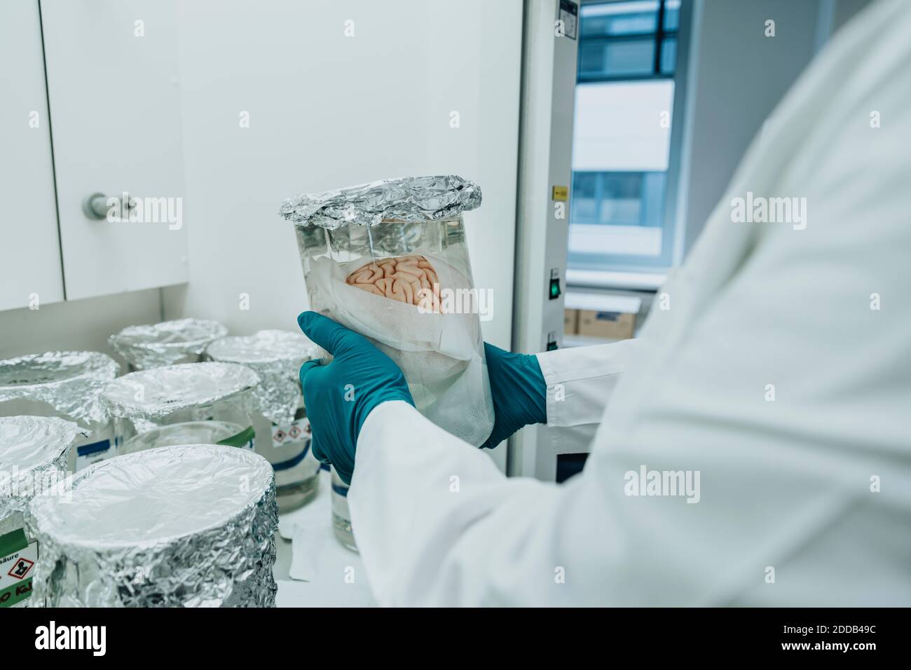 Scientist holding preserved human brain beaker while standing at ...