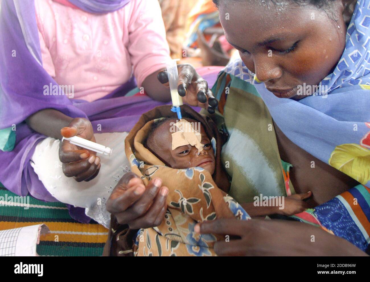 Severe malnourishment hi-res stock photography and images - Alamy