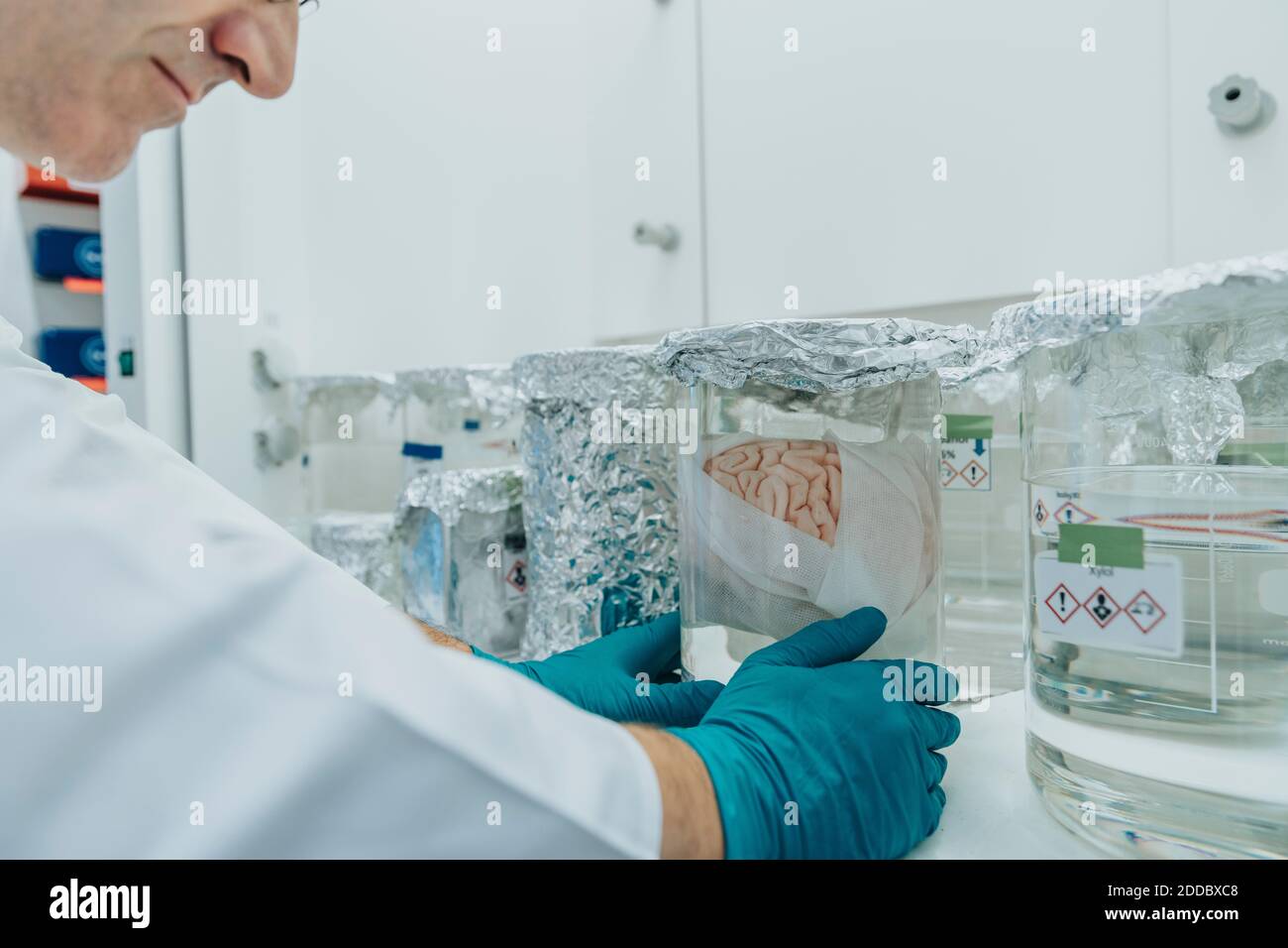 Man arranging human brain beaker while standing at laboratory Stock ...