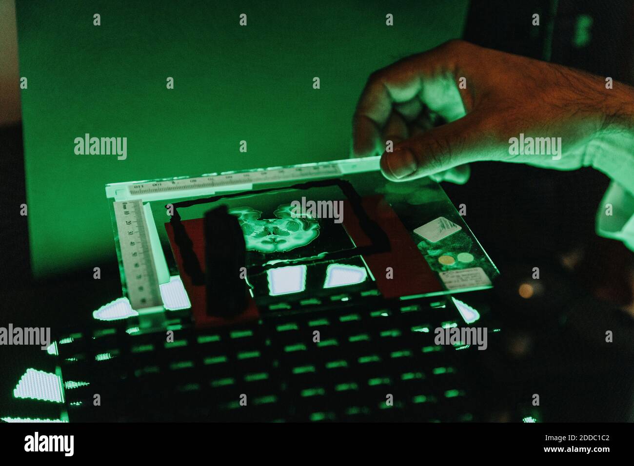 Close-up of scientist hand adjusting human brain slide on microscope at ...