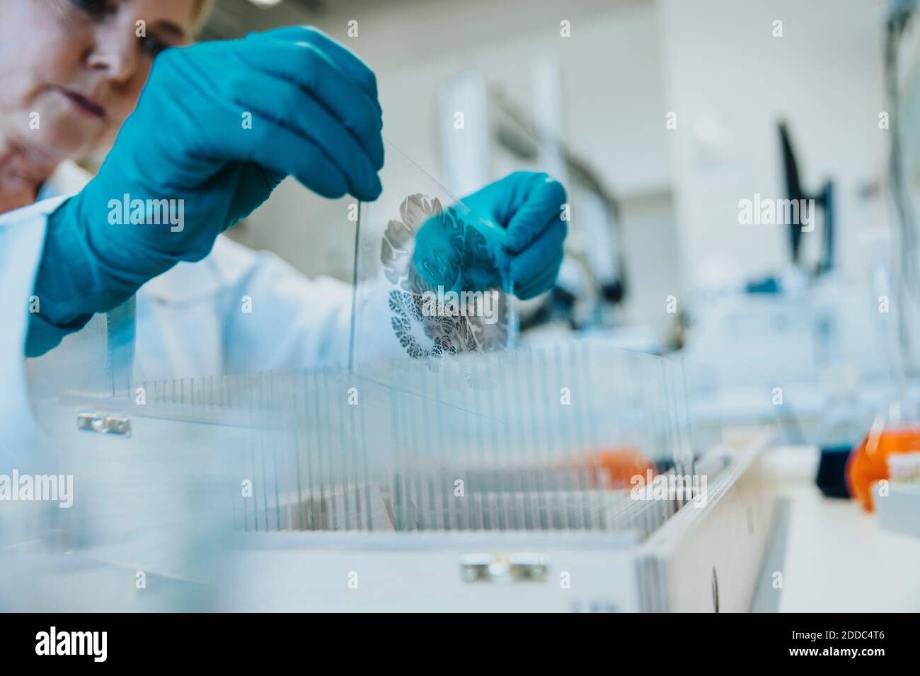 Human organs and brain hi-res stock photography and images - Alamy