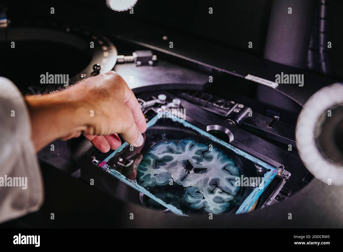 Close-up of scientist hand removing human brain slide from microscope ...