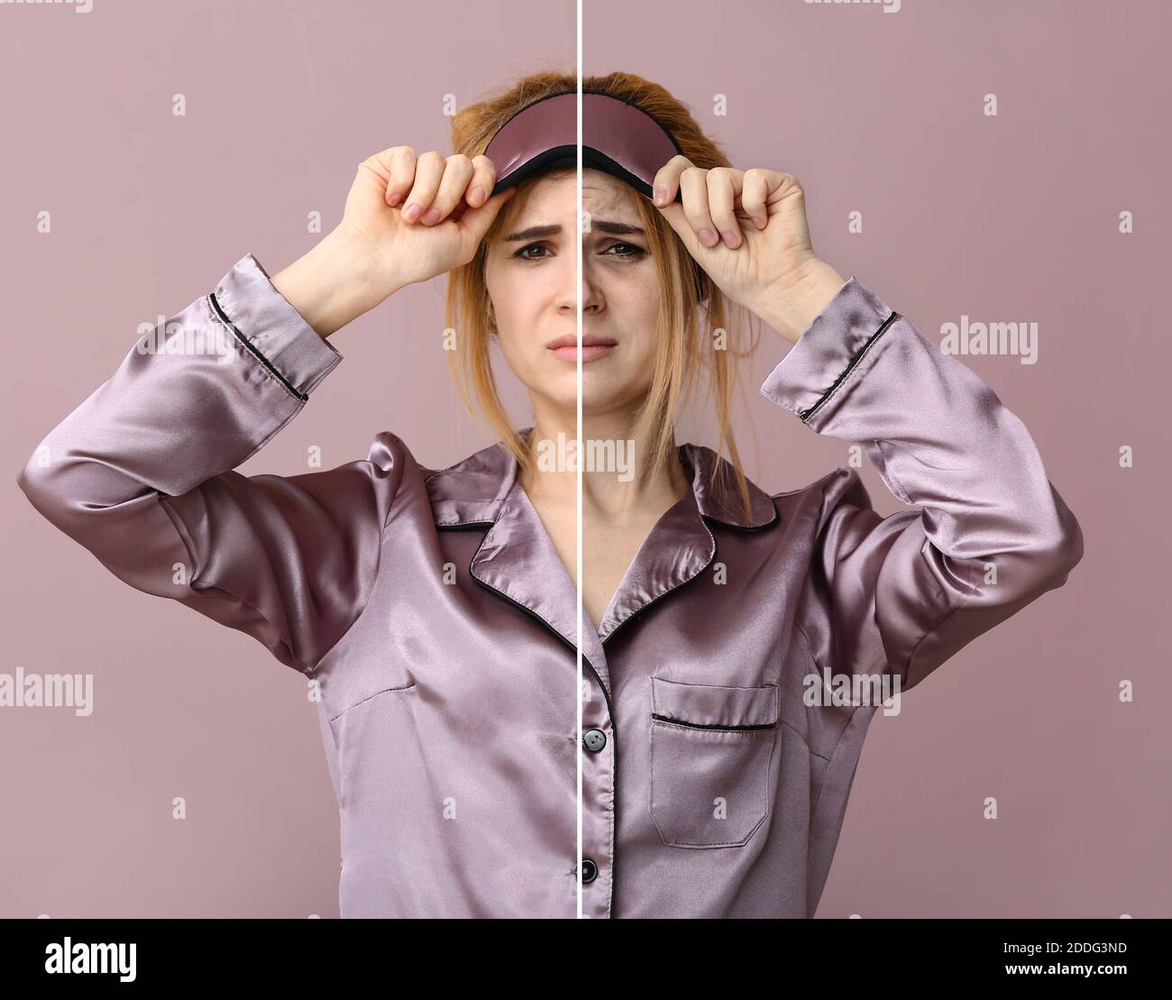 Comparative portrait of woman with and without sleep deprivation ...