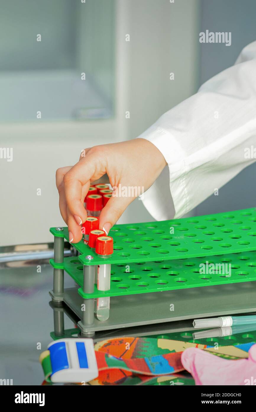 Blood typing in a lab hi-res stock photography and images - Alamy
