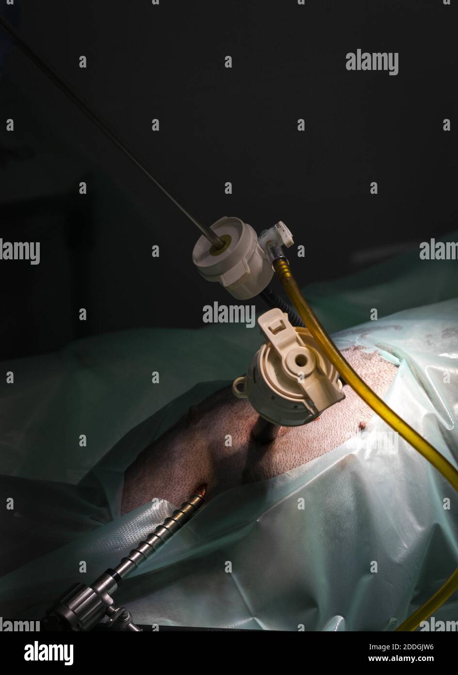 A vertical shot of a veterinarian performing surgery on a dog with ...