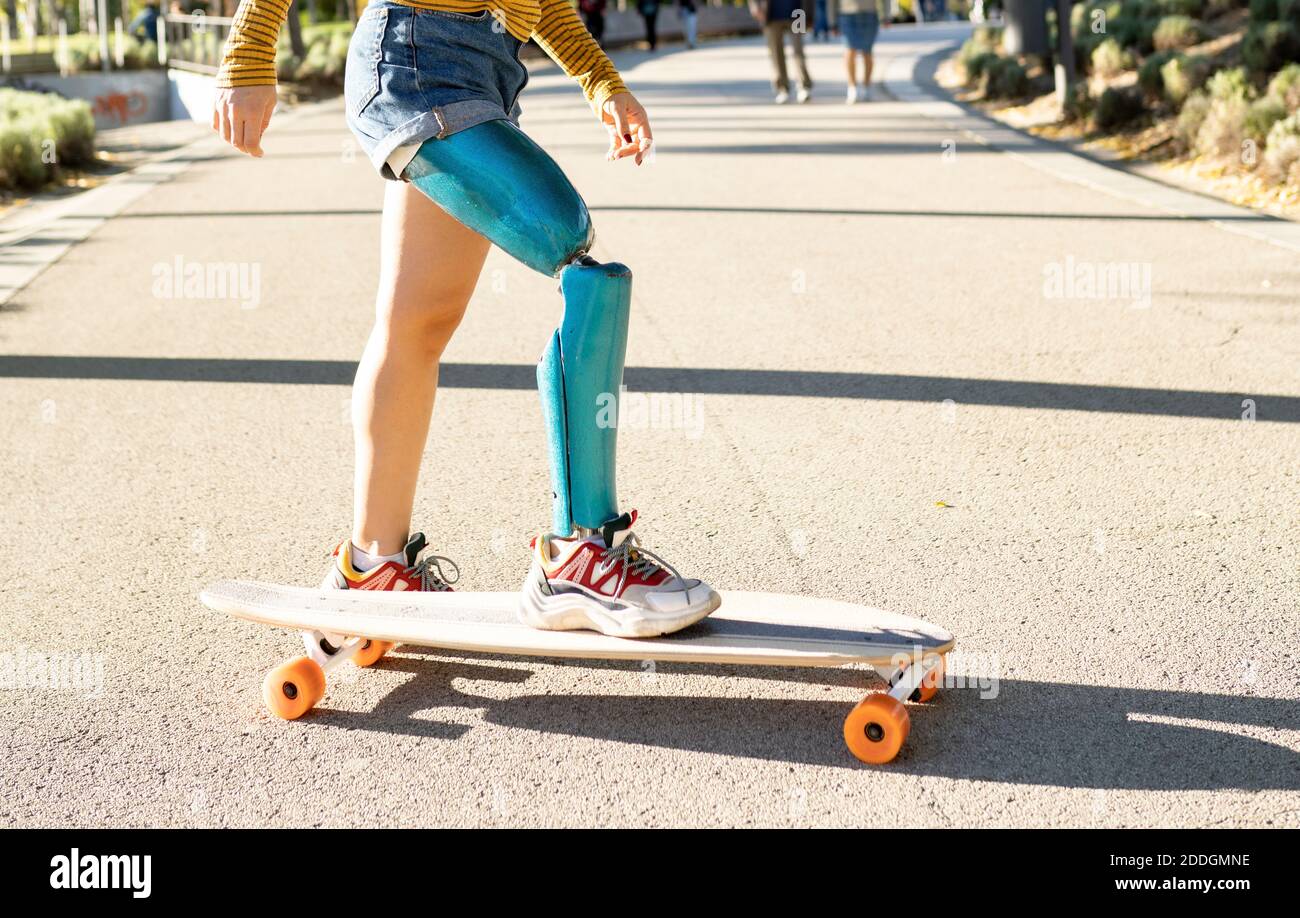 Crop side view of positive female with leg artificial limb of leg ...