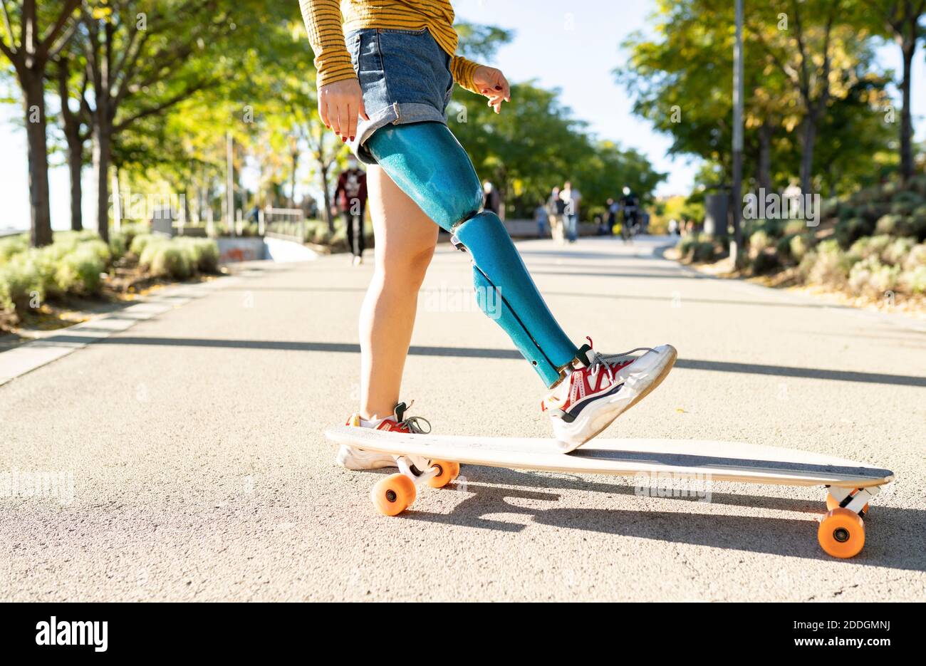Crop side view of positive female with leg artificial limb of leg ...