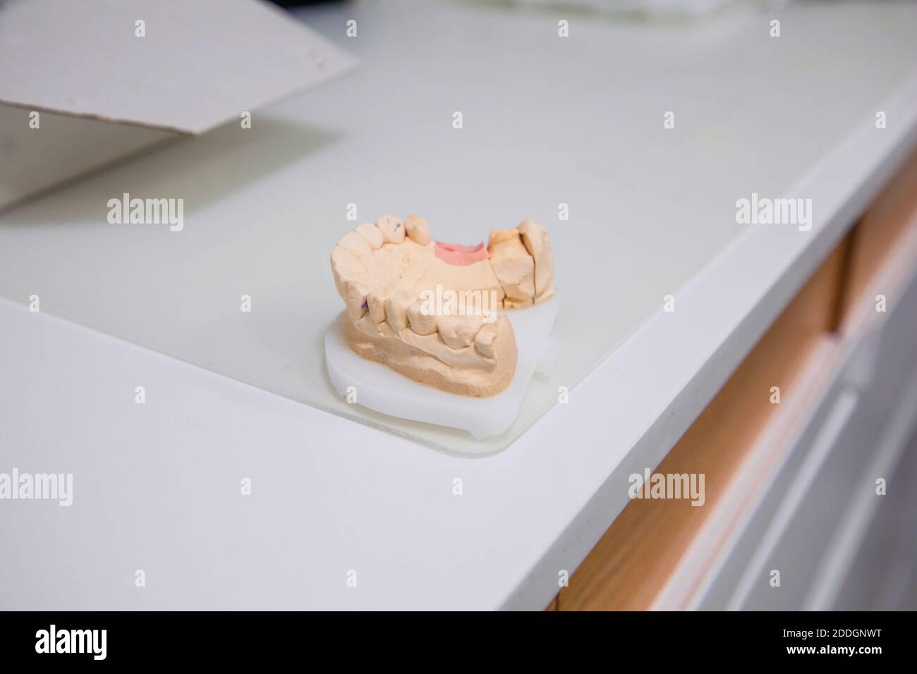 Plaster cast of jaw placed on white table in medical room of modern ...