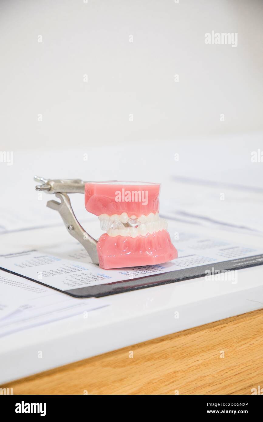 Closeup of white dental cast placed on white surface in modern ...